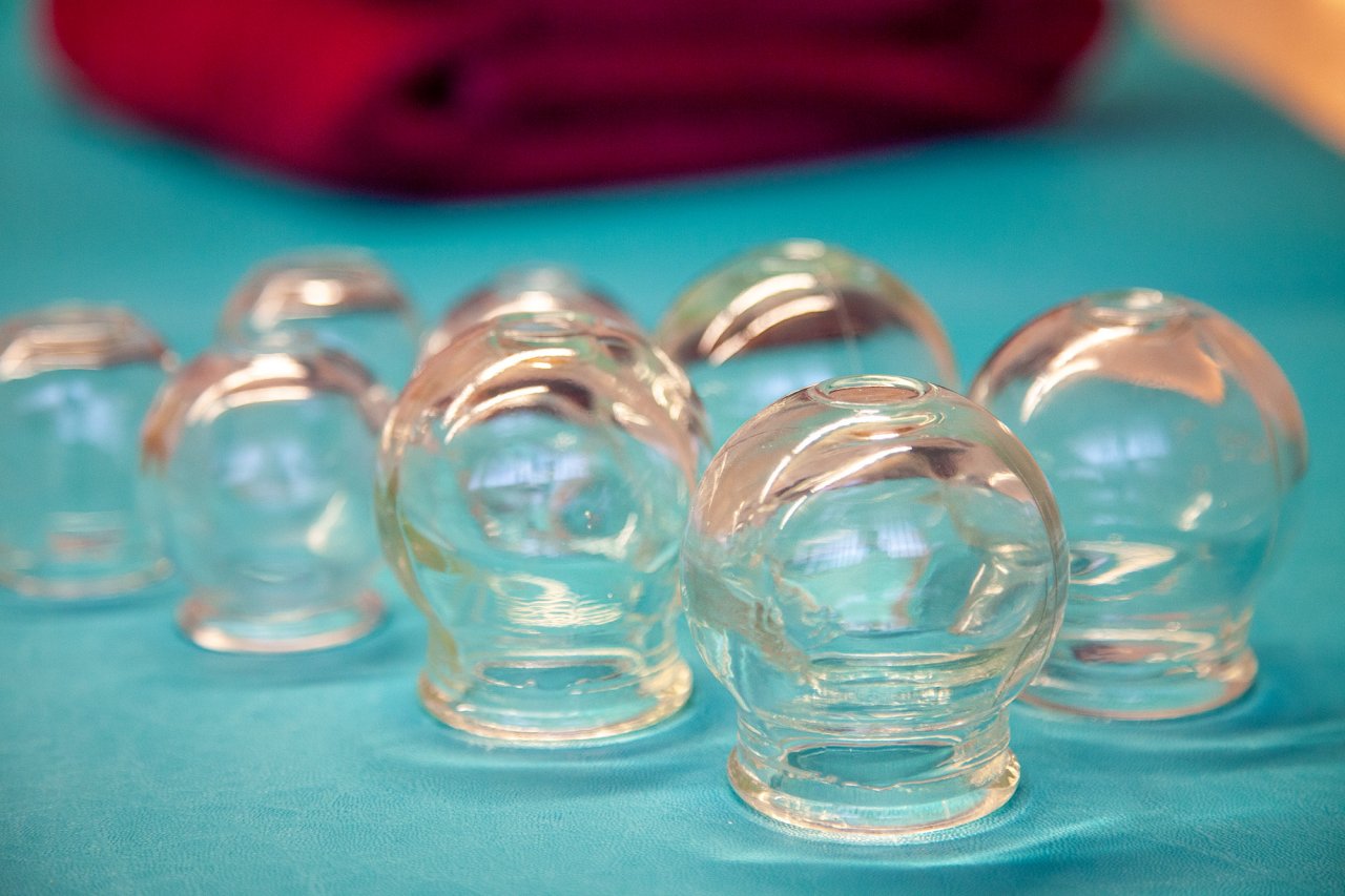 Thérapie ventouses | cabinet-virginievoide